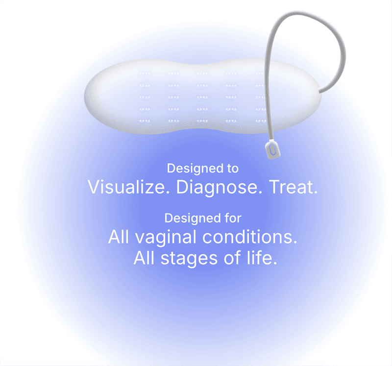 Candidiasis Vaginal Enhanced Efficacy Of Hybrid Vaginal Ovules Against
